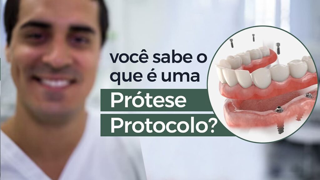 Implantes - Maragno Odontologia