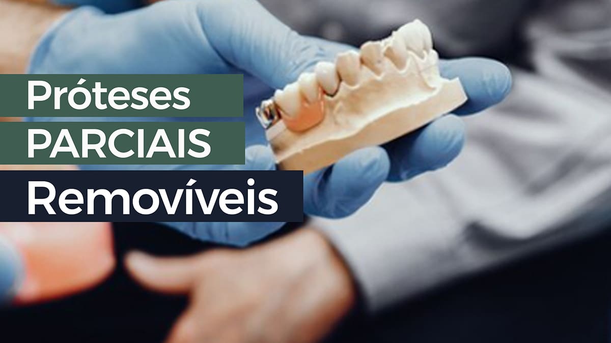 Próteses - Maragno Odontologia