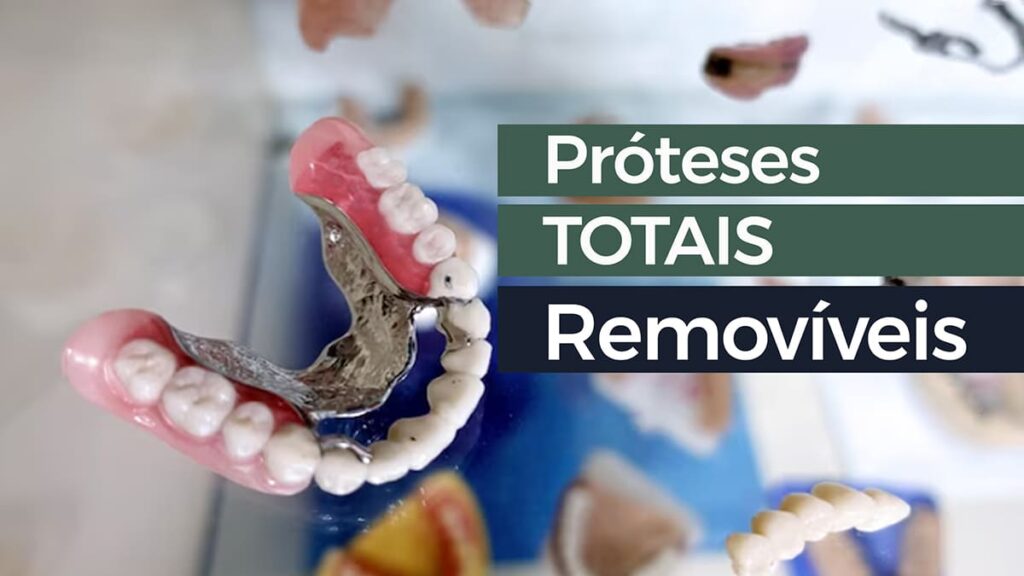 Próteses - Maragno Odontologia